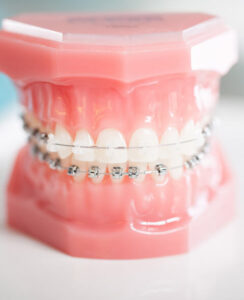Specialty Orthodontics Walkerville | Helping patients achieve a smile ...